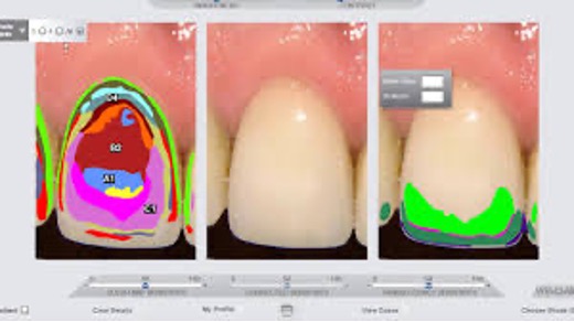 5 | Dental Laboratory AssociatesDental Laboratory Associates