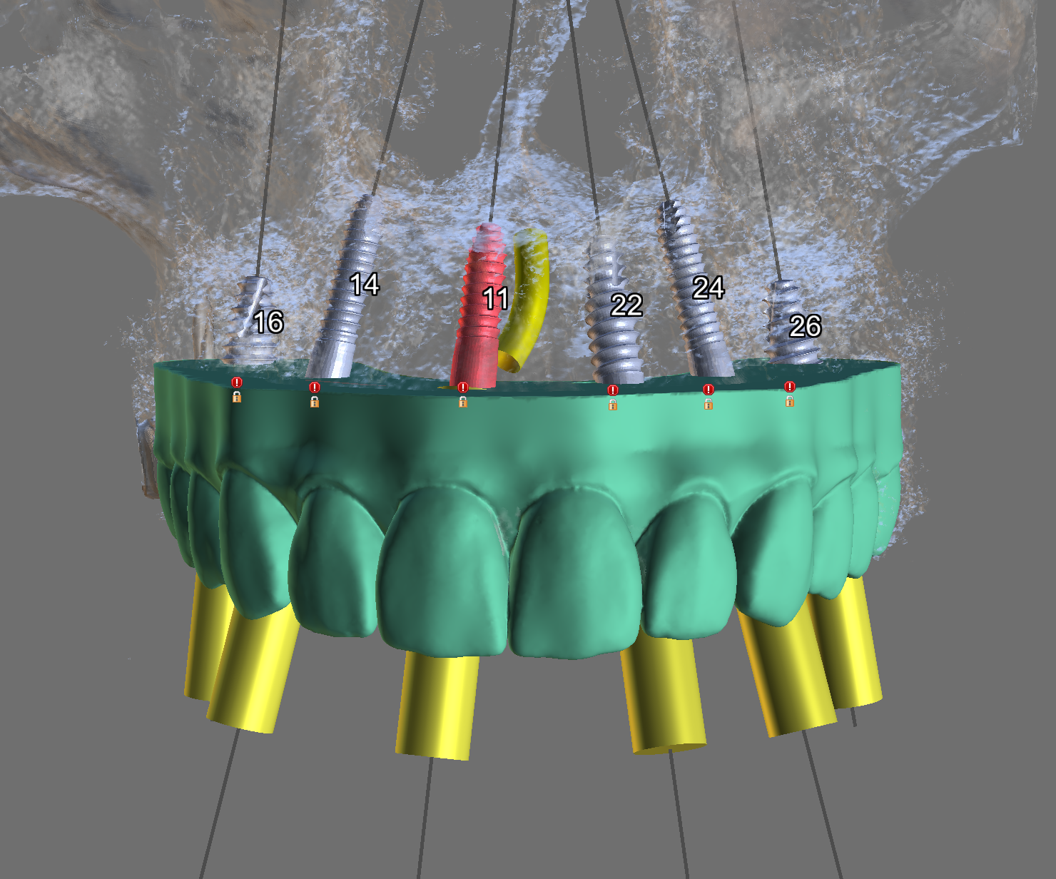 Implant Planning Form | Dental Laboratory AssociatesDental Laboratory ...